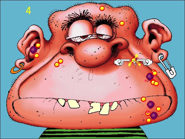 Acne Attack - Old Games Download