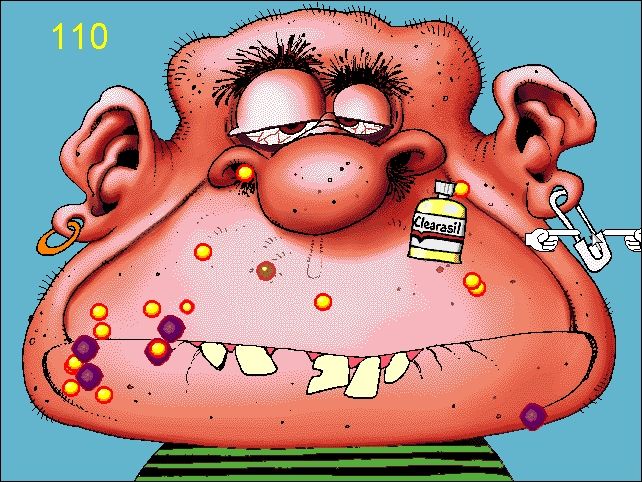 Acne Attack - Old Games Download
